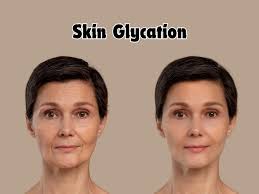 Skin Glycation: The Hidden Aging Accelerator and How to Reverse Its Effects